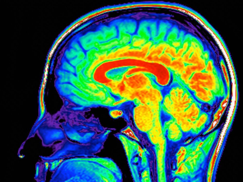 NOTRE CERVEAU NE VEUT PAS DU COVID… - SOS Hépatites