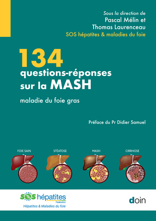 134 QUESTIONS - RÉPONSES SUR LA MASH - SOS Hépatites